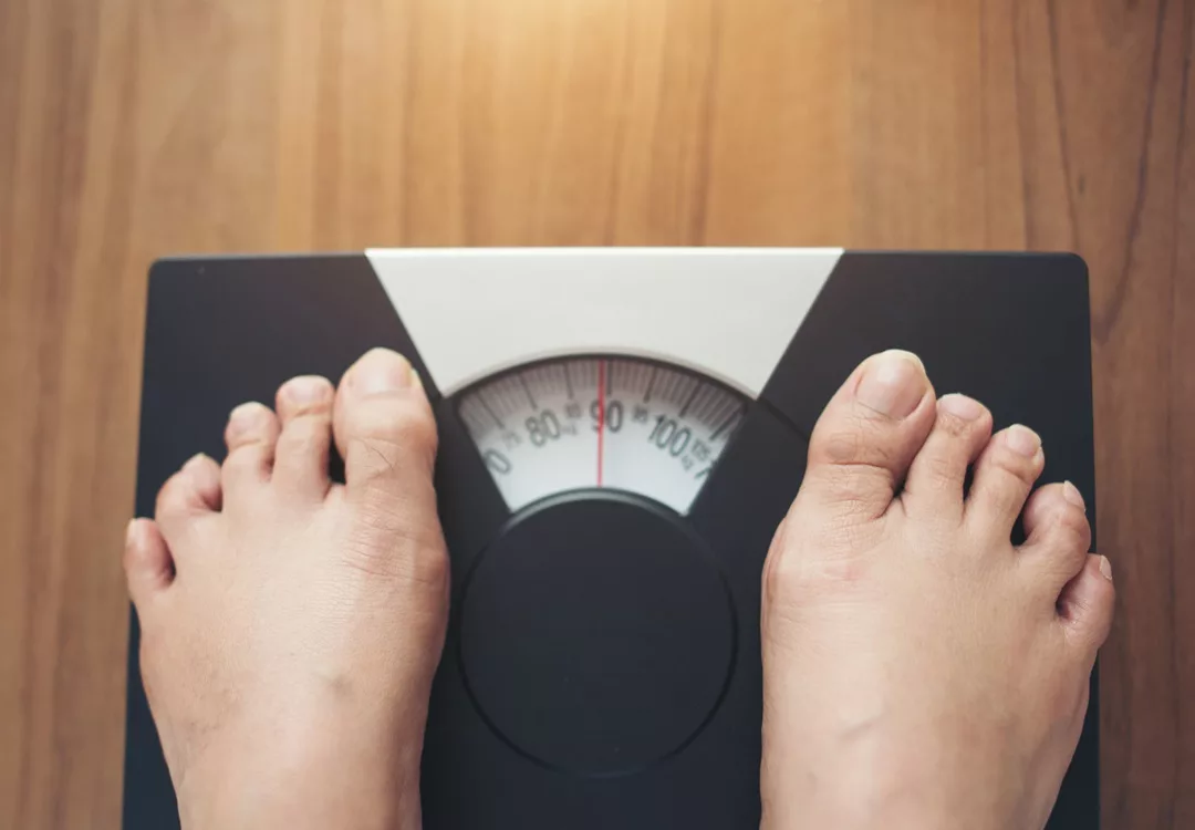 Obesity Feet and treatment - Foot & Ankle Center of Arizona